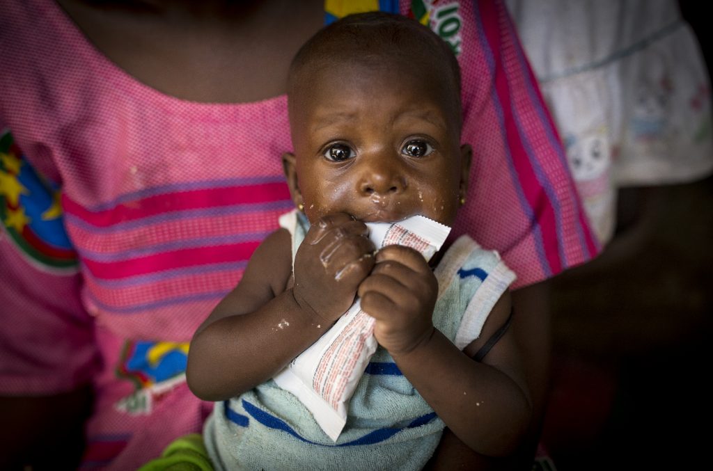 Severe Acute Malnutrition | A Silent Emergency | Donate Now