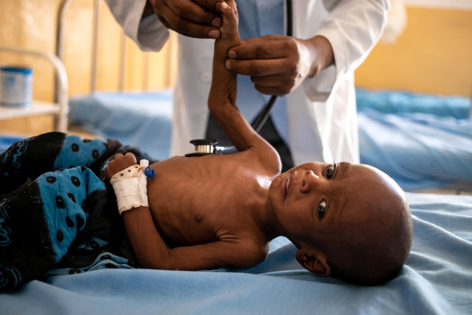 Horn of Africa Hunger Crisis | Donate Now | UNICEF Ireland